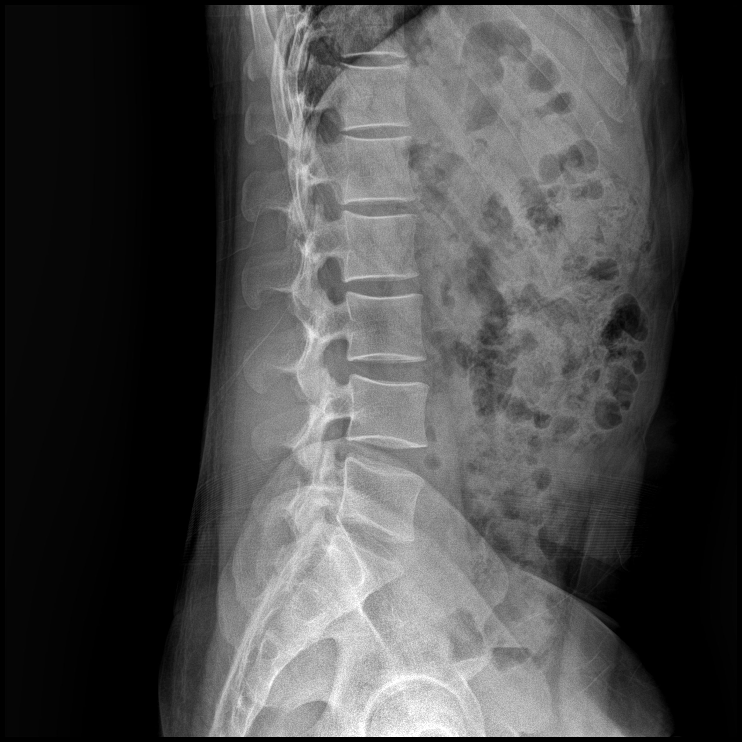 NeuDR 1717 - Mekosha Healthcare